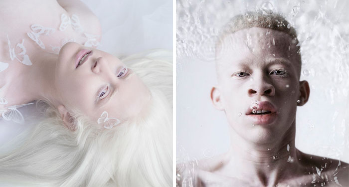 58 Albino People Who’ll Mesmerize You With Their Otherworldly Beauty ...