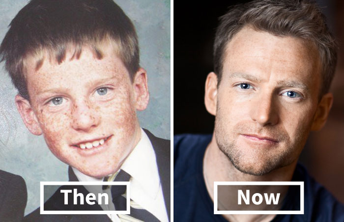 People Share Their Incredible “Ugly Duckling” Transformations And It’s ...