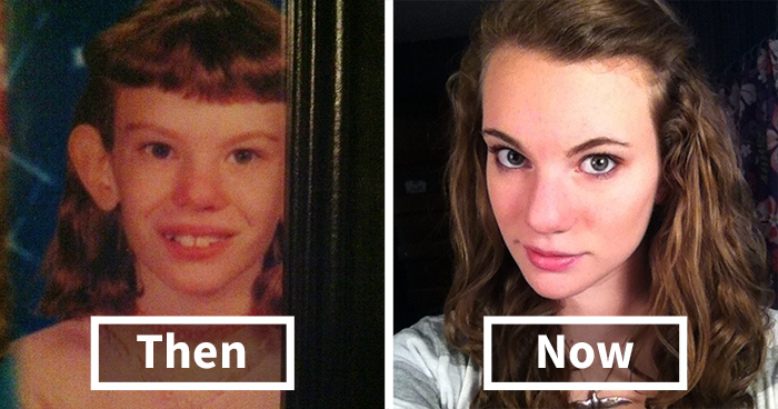 People Share Their Incredible “Ugly Duckling” Transformations And It’s ...