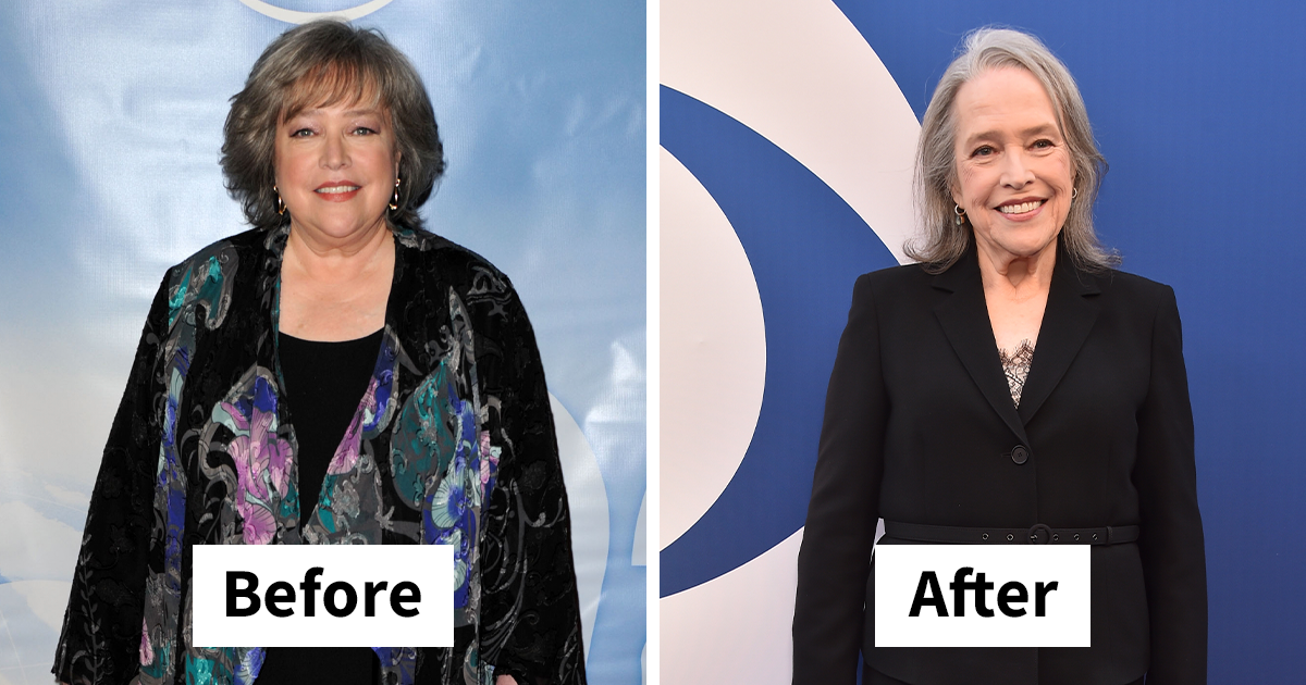 “I’m Ashamed”: Kathy Bates Reveals 100 lb Weight Loss And Explains How ...