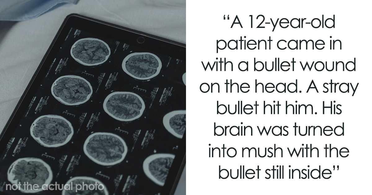 30 Doctors Share The Weirdest And Most Disgusting Things Found In ...