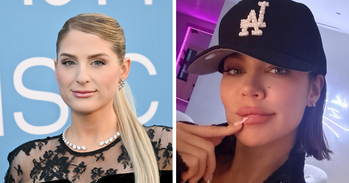 15 Before-And-After Photos Of Celebs Who Replaced Regular Botox With ...