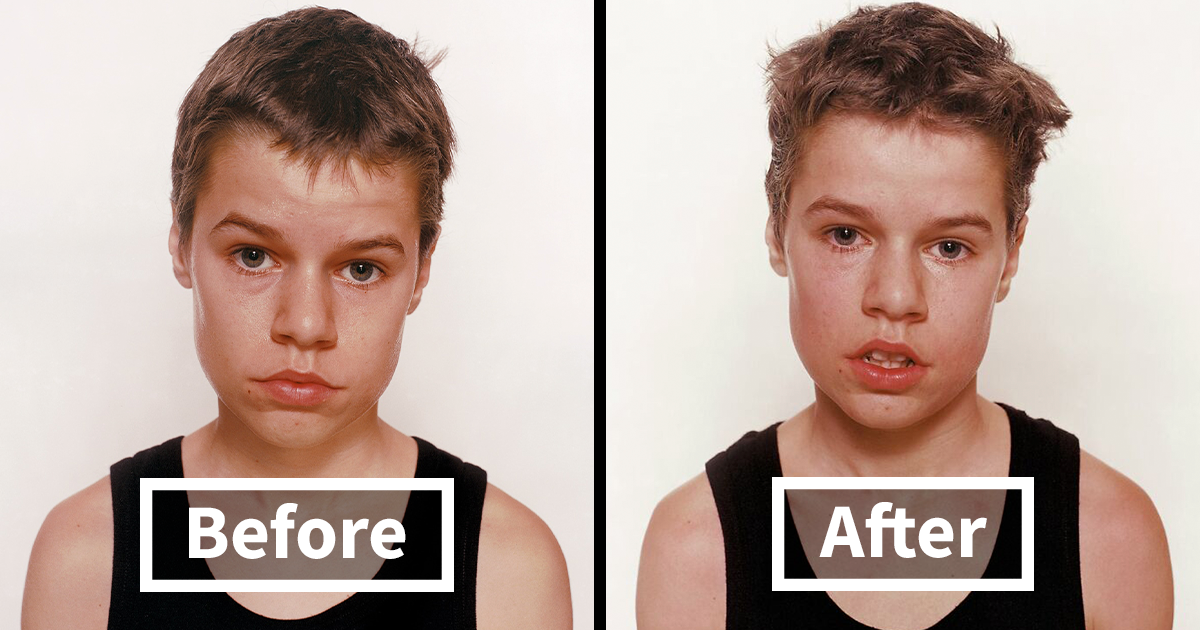 18 Powerful Photographs Of Young Boxers Before And After Their First ...