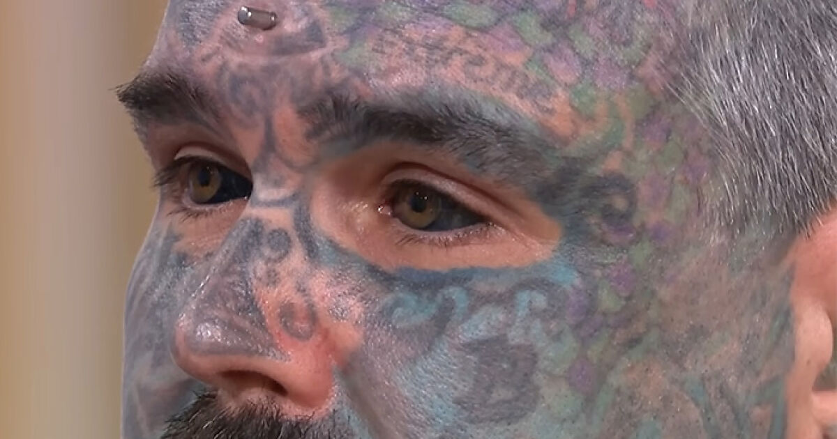 "Total Stupidity!": Man Who Got His Eyeballs Tattooed Reveals Dangerous ...