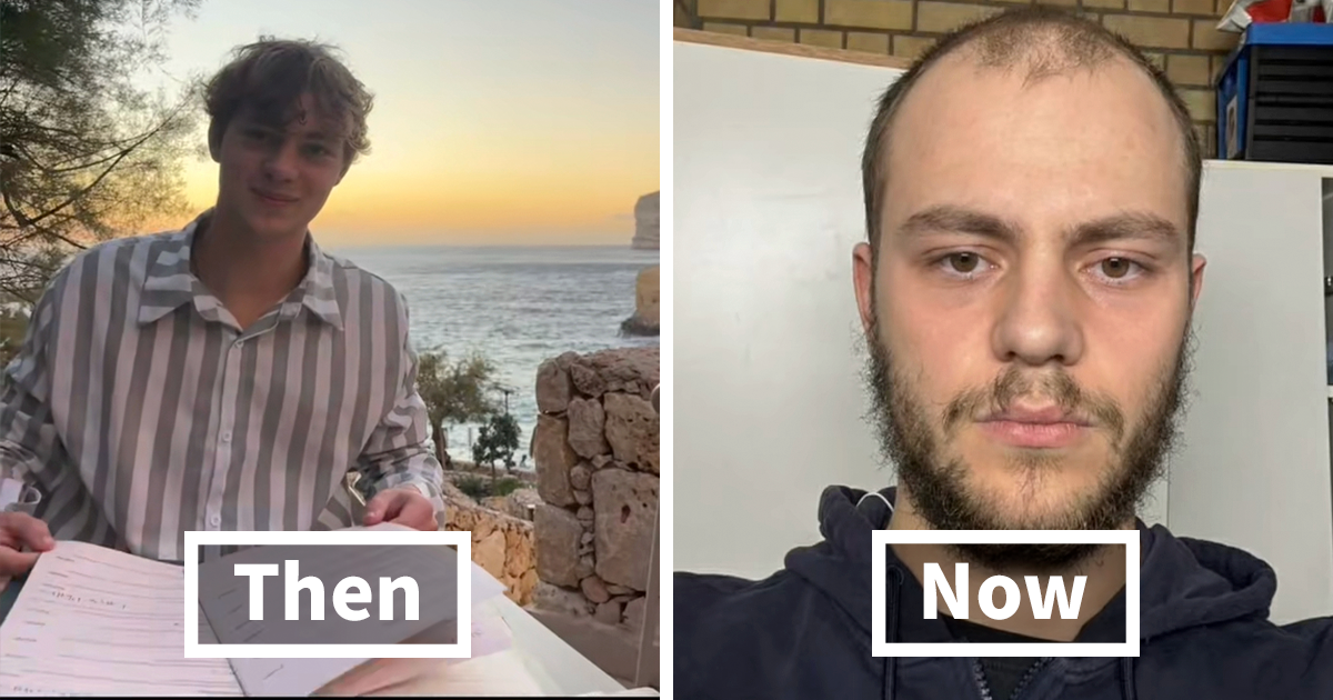 67 People Get Vulnerable By Sharing How They’ve Glowed Down Since They ...