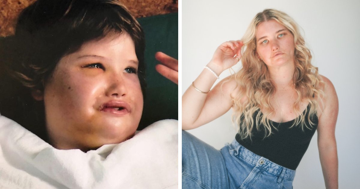 17 Bizarre Medical Problems And Mysteries That Catapulted People Into ...